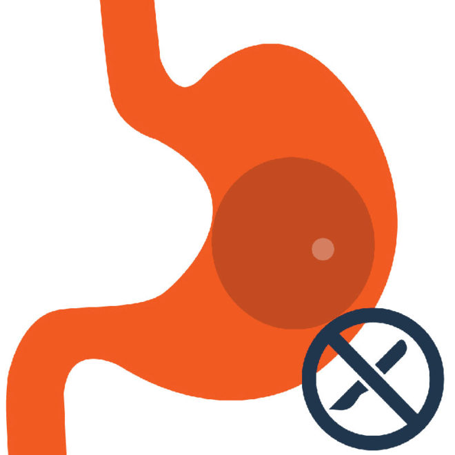 What Is Gastric Balloon and How It Works | Gastric Balloons