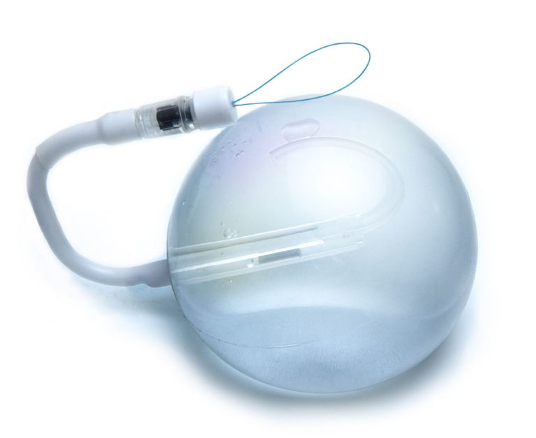 Non Surgical Weight Loss Treatment 10 to 30 KGs | Gastric Balloon